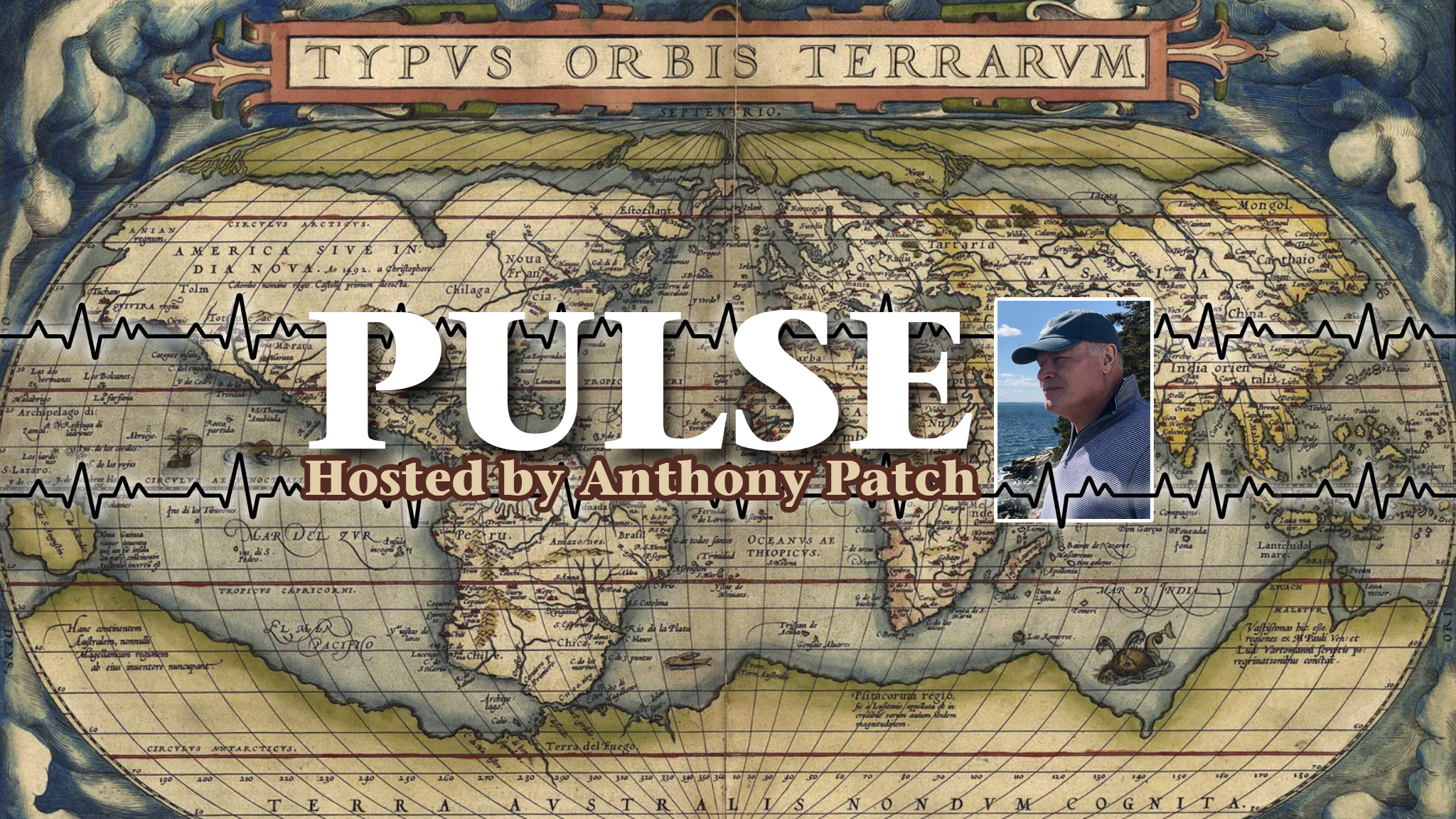 Anthony Patch - Home